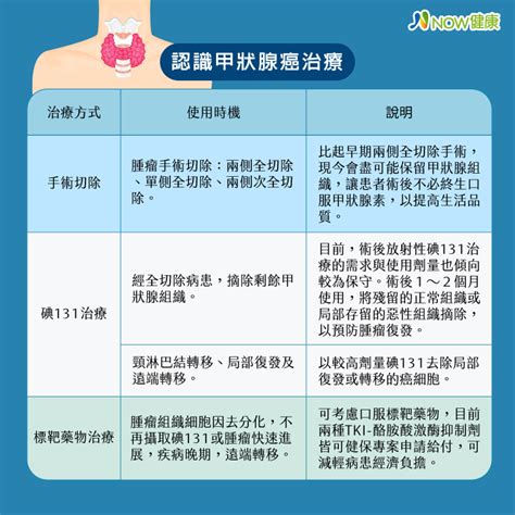 甲狀腺癌有善良癌症稱號醫師詳解 1圖看懂晚期甲狀腺癌治療方式