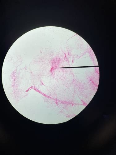 Flashcards Lab Exam 4 Extra Questions Quizlet