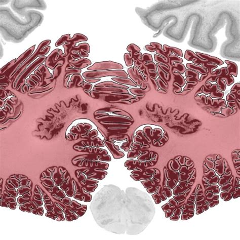 Segmentation All Datasets Were Indexed In Our Collaborative Web Download Scientific Diagram