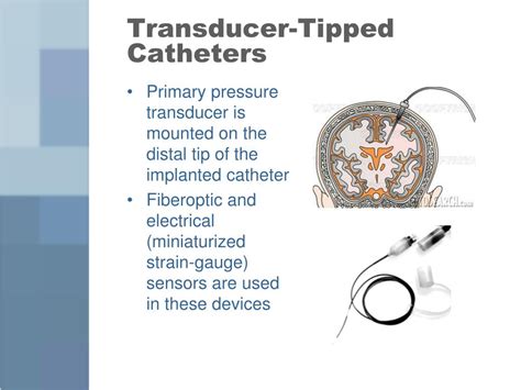 Ppt Icp Monitoring Powerpoint Presentation Free Download Id 2179158