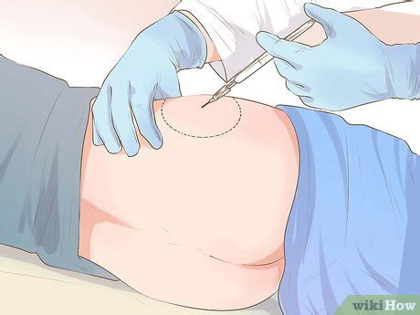 4 Ways To Give An Injection WikiHow