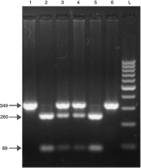 Mannose Binding Lectin Gene Polymorphism And Its Effect On Short Term Outcomes In Preterm