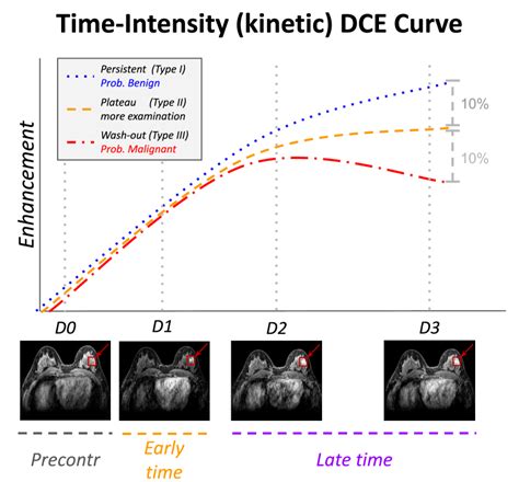 A Time Intensity Aware Pipeline For Generating Late Stage Breast Dce