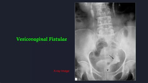 ASU MCU RADIOLOGY IMAGING PROCEDURE PPTX