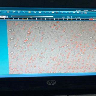 Computerized Semen Analyzer Apparatus Download Scientific Diagram