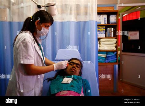 Hypertrichosis Treatment Before And After