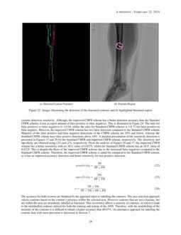 Long Bone Fracture Detection Using Artificial Neural Networks Based On