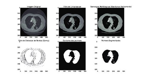 Processo De Segmentação Das Imagens Dos Pulmões No Sistema Lcd Download Scientific Diagram