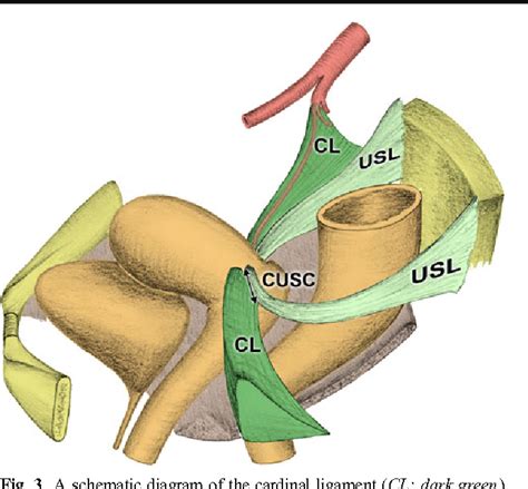 Cardinal Ligament Surgical Anatomy Cardinal Points At Hysterectomy Semantic Scholar
