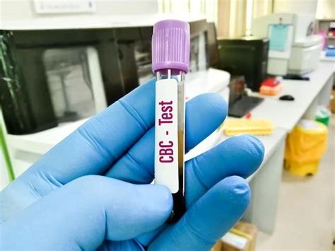 Understanding The Components Of A CBC Test Biocity Healthcare