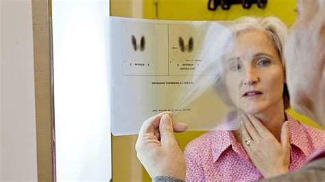 Atrial Fibrillation Causes And Complications