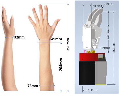 Figure 1 From A Transradial Prosthesis With A High Functional Wrist For Various Daily Living