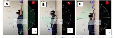 Figure 1 From Remote Visual Estimation Of Shoulder Range Of Motion Has