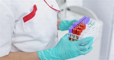 혈액 튜브 테스트를 들고 있는 실험실 기술자의 손과 혈액 샘플이 있는 컬러 튜브 랙 다른 환자혈액 튜브 테스트를 들고 있는 실험실 기술자 사진 Unsplash의