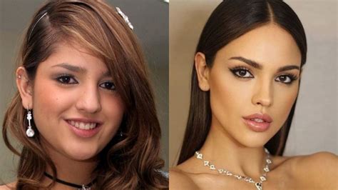 Eiza González Antes Y Después Cirugías La Sorprendente Apariencia De