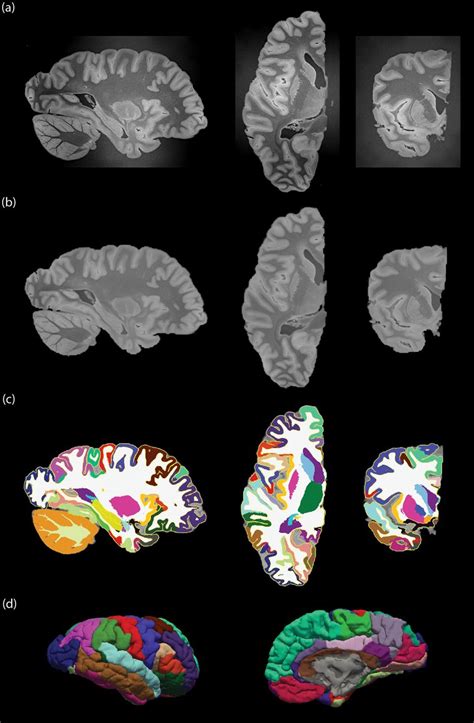 Overview Of The Main Mri Preprocessing Steps A The Raw Ex Vivo Mri