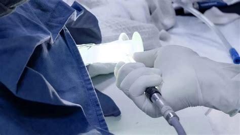 Sigmoidoscopy Procedure