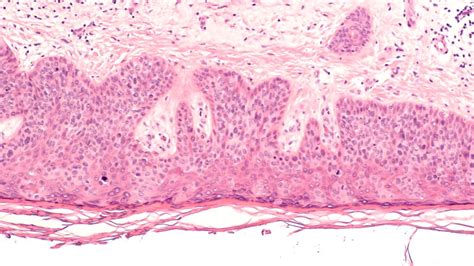 Skin Structure Anatomy And Function Cosmetic Science