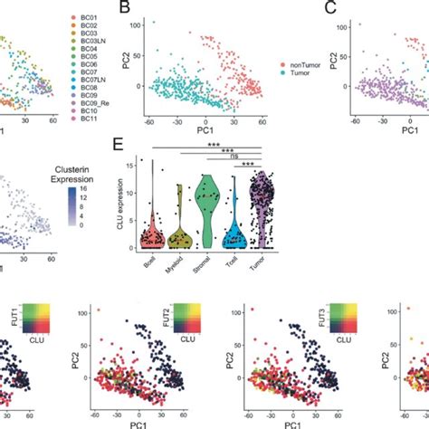 Single Cell Analysis In Breast Cancer Unsupervised Principal Component