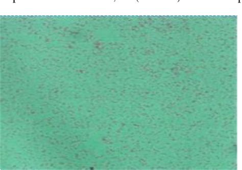 Figure 3 From Molecular Detection And Characterization Of Salmonella Spp Isolated From Fresh