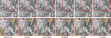 Self Supervised Super Resolution Approach For Isotropic Reconstruction