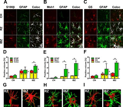 Figure 2 From Object Based Analysis Of Astroglial Reaction And