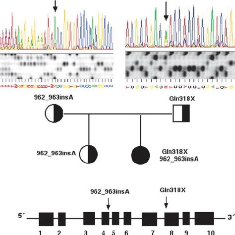 Cyp21a2 Mutation Analysis Top Sequence Analysis Showing The Novel