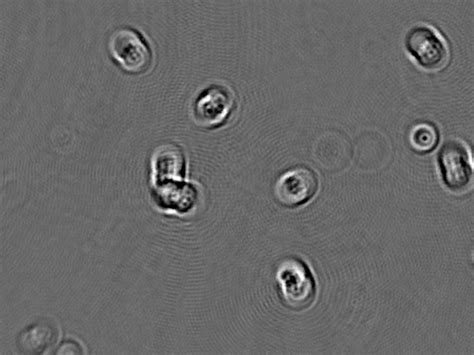 Bacterial Only Object Detection Dataset By Abha Gejji