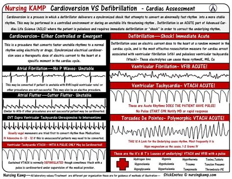 Cardiac Cardioversion Vs Defibrillation Defibrillation Vs Cardioversion