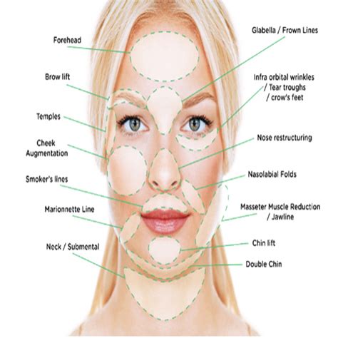오로 Pdo 리프트 얼굴 Pdo 스레드 코그 의 고품질 오로 Pdo 리프트 얼굴 Pdo 스레드 코그