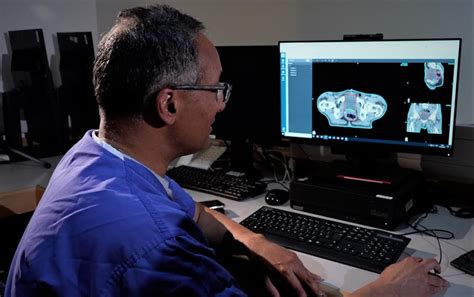 AI Speeding Up Radiotherapy Preparation