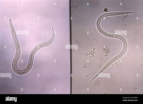 Hookworm And Strongyloides Filariform Infective Stage Larvae Revealed In The Micrograph Film