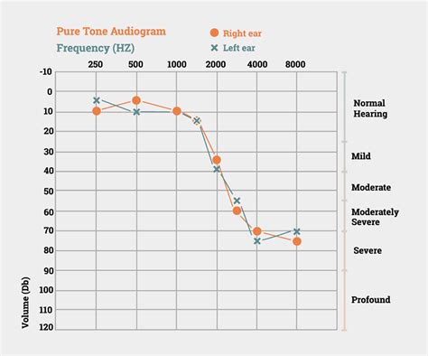 Audiograms How To Interpret Your Hearing Test Resultshearing And Hearing Loss