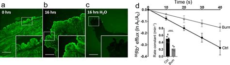 The Choroid Plexus Remains Viable Ex Vivo A Calcein Am Staining Of Download Scientific Diagram