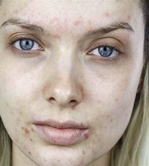 File Chastity Pic Png Fulcrum MUSH Wiki File Chastity Pic Png Fulcrum MUSH Wiki