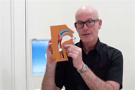 Why Experts Recommend Mandibular Splints For Sleep Apnoea