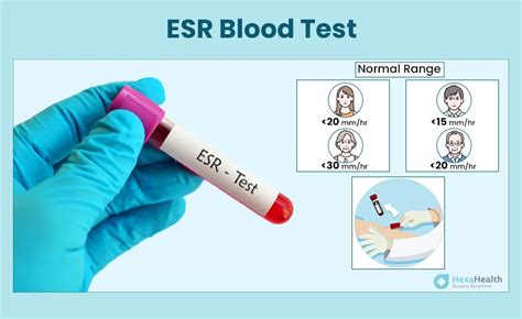 ESR Blood Test Normal Range Cost Purpose Result