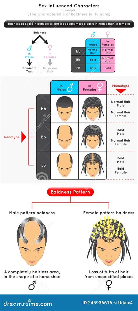 Sex Influenced Characters Infographic Diagram Example Characteristic Of Baldness In Human Vector