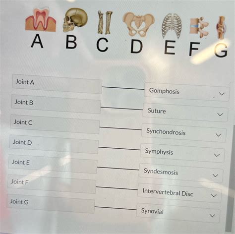 Solved Match The Joints With Their Corresponding Structure Name