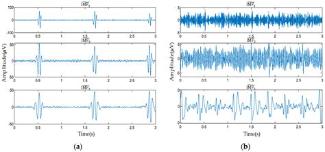 Detection Of Ventricular Fibrillation Using Ensemble Empirical Mode Decomposition Of Ecg Signals