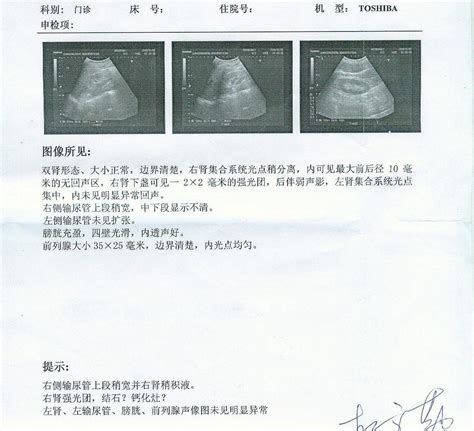 肾结石彩超图片说明 千图网