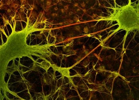 Artificial Neural Network Artificial Neural Network Architecture