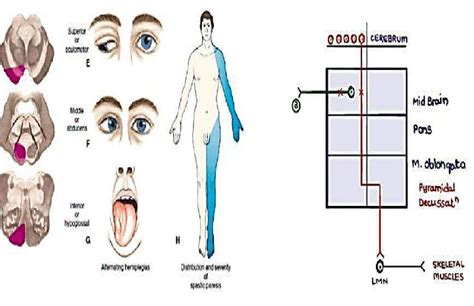 Transverse Section Of The Midbrain