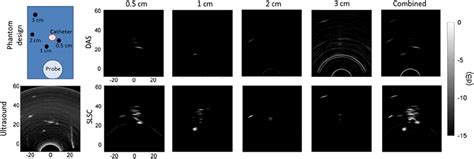 Phantom Schematic Diagram And Curvilinear Ultrasound US Image Of The Download Scientific