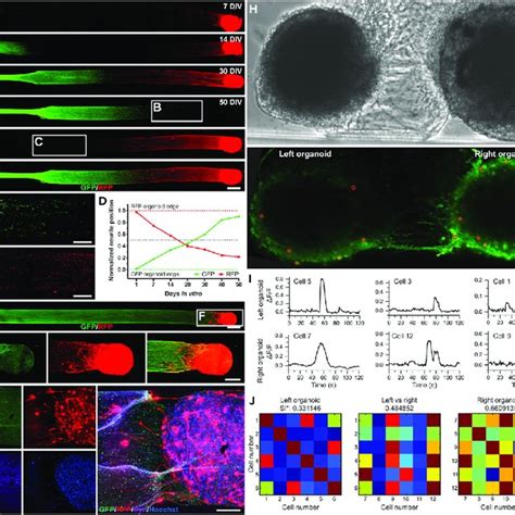 Anatomic And Functional Integration In Ipsc Derived Brain Organoid Download Scientific Diagram