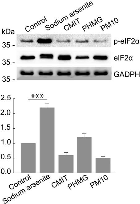 Phosphorylation Of Eif2α Is Affected Under Cellular Stresses In Hpaepic