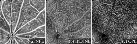User Guided Segmentation For Volumetric Retinal Optical Coherence Tomography Images