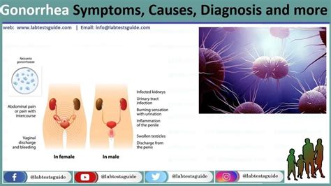 Gonorrhea Lab Tests Guide