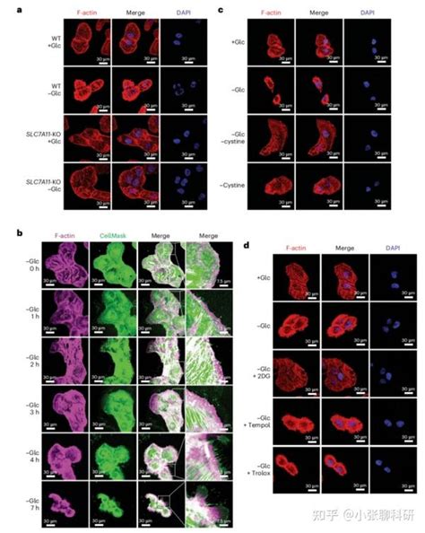 想了解双硫死亡，你一定要看这篇文献详解 知乎