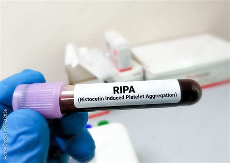 Unlocking The Power Of Ristocetin Induced Platelet Aggregation Testing With Platelet